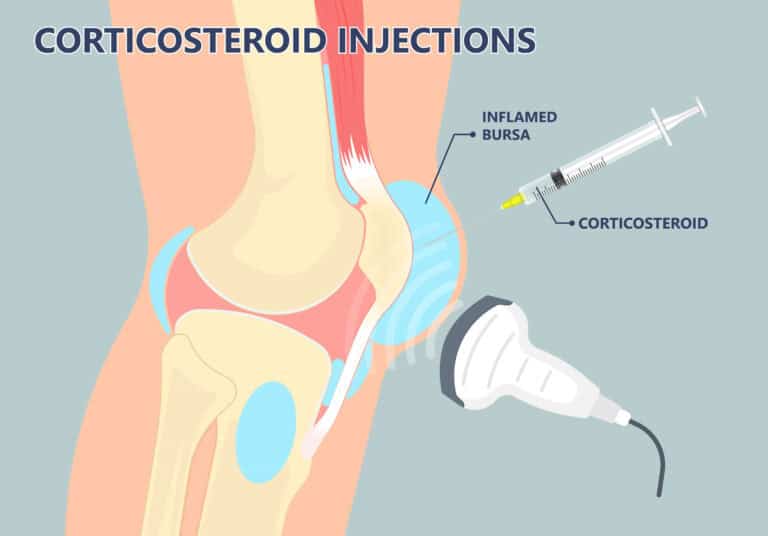 What Causes Bursitis? A Guide to Pain Relief | NextCare